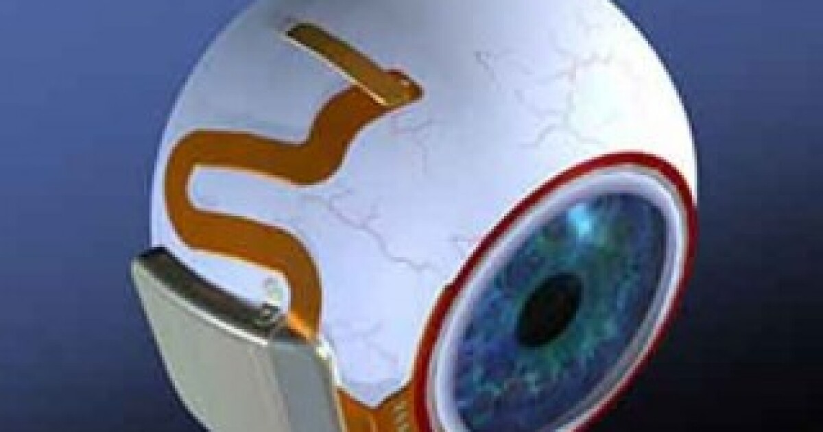 Electric Eye: Creating a Visual Prosthesis for the Blind | GBH